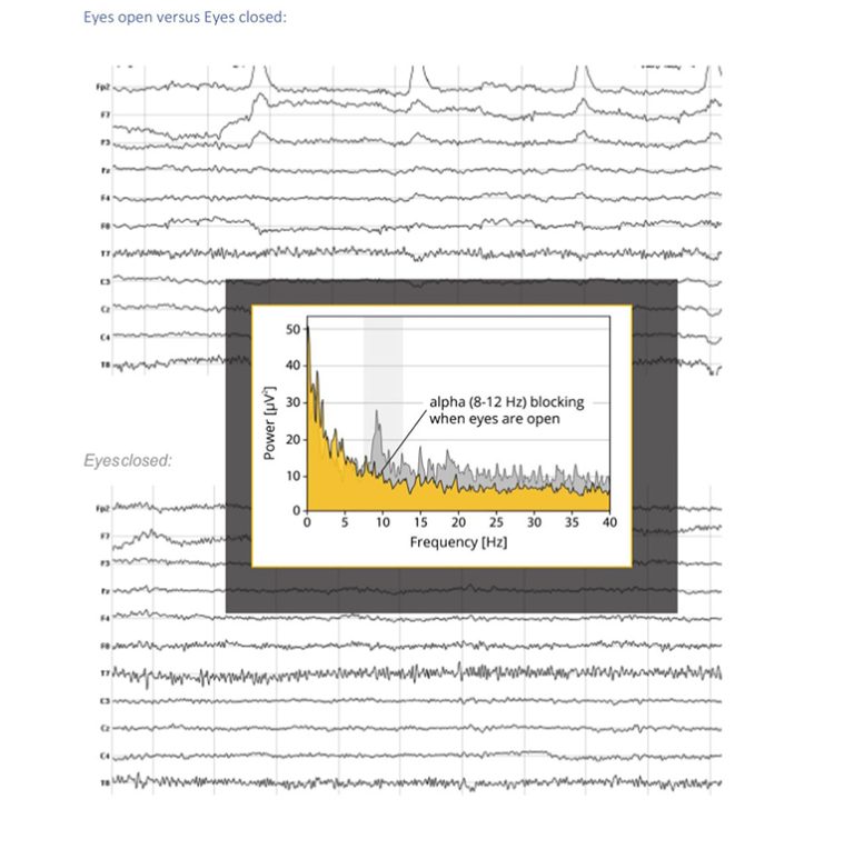 Peak Performance: Brain & Trauma Services in Tampa